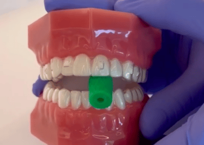 Aligner Care - True North Orthodontics