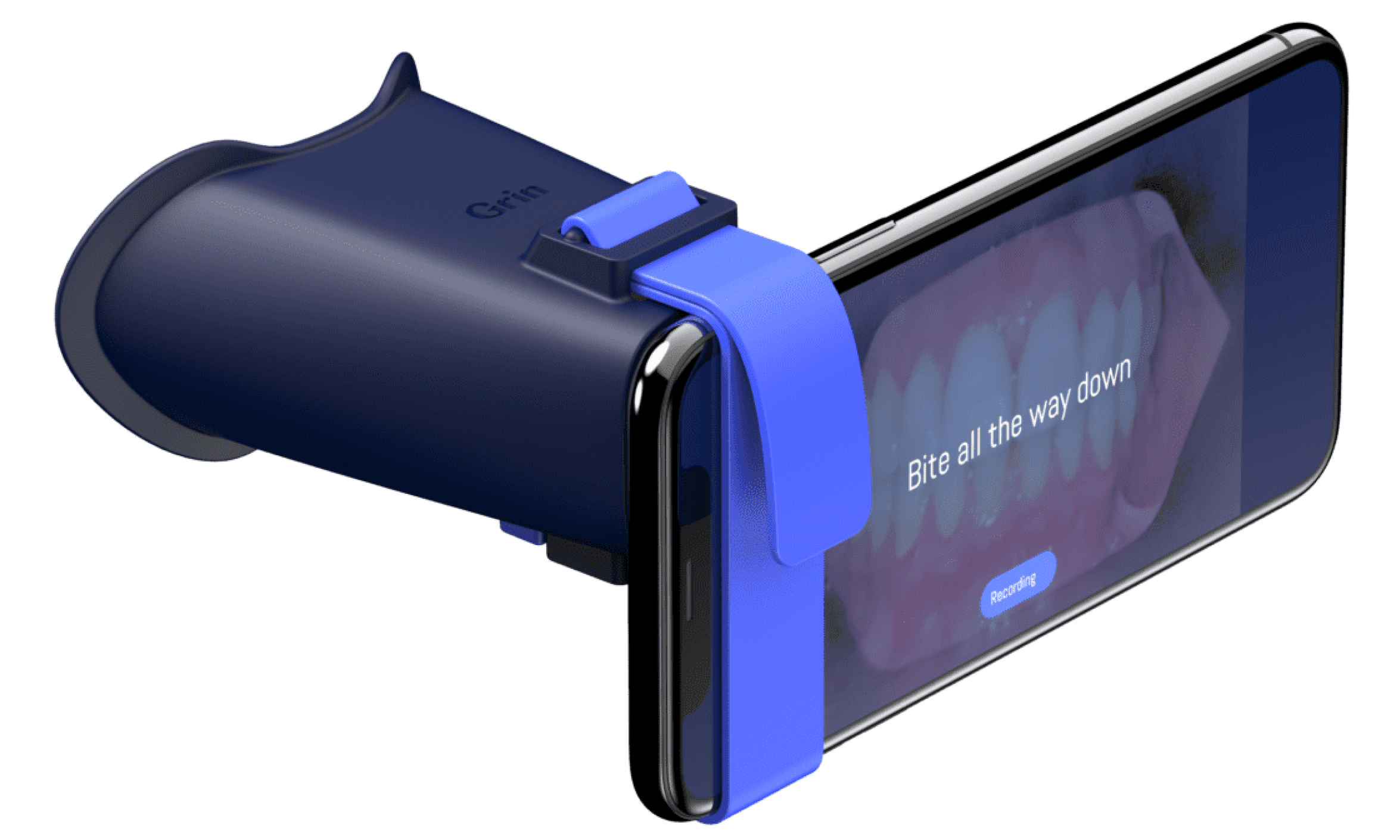 Grin Remote Monitoring - True North Orthodontics