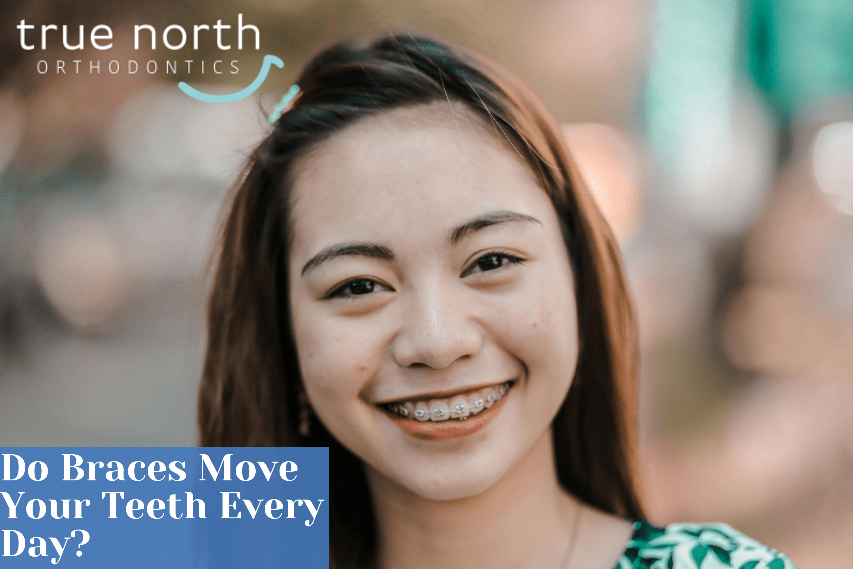 Do Braces Move Your Teeth Every Day? | True North Orthodontics - True North Orthodontics